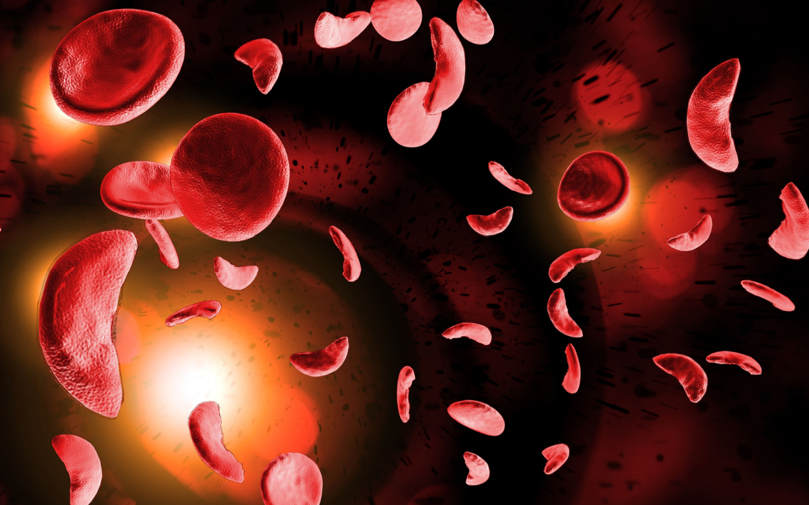 Sickle-cell Anaemia – Monmouth Academy