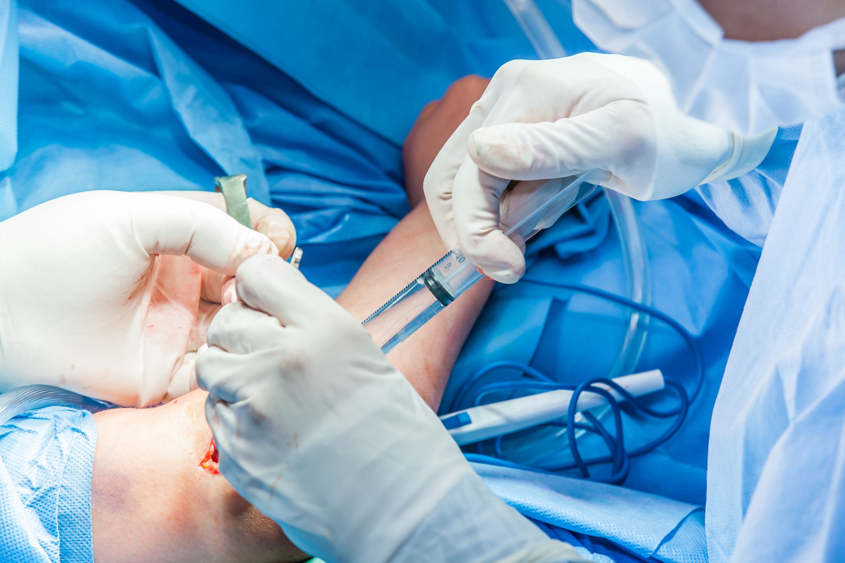 Elbow diagnoses and procedures – Monmouth Academy